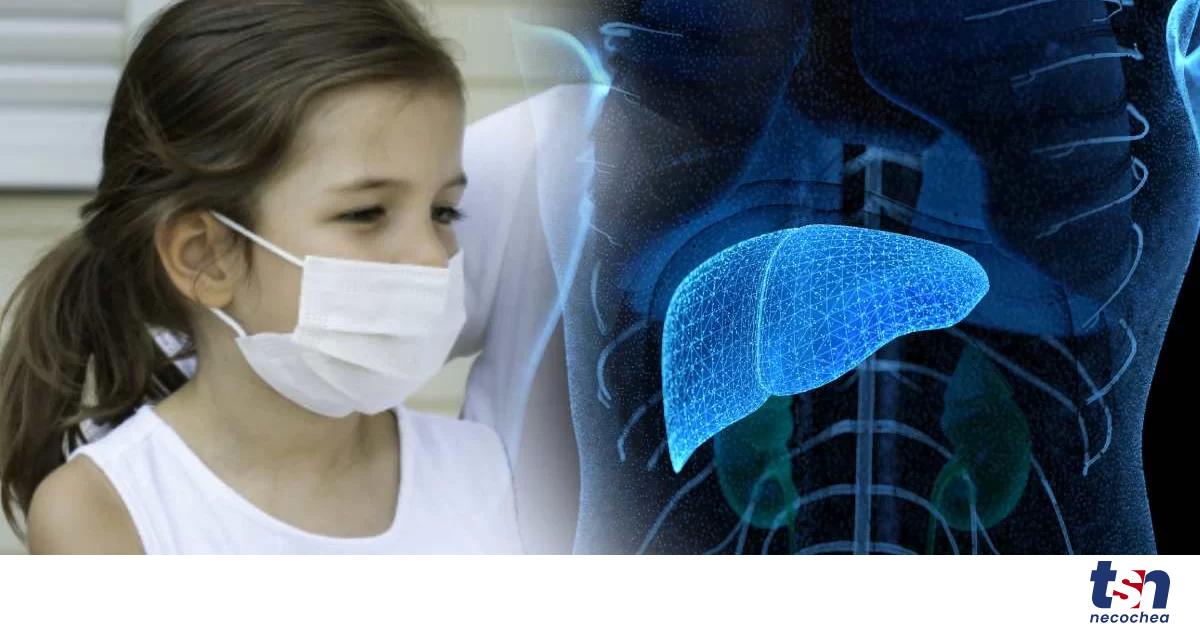 Detectaron el primer caso de hepatitis aguda grave infantil en ... Detectaron el primer caso de hepatitis aguda grave infantil en ...